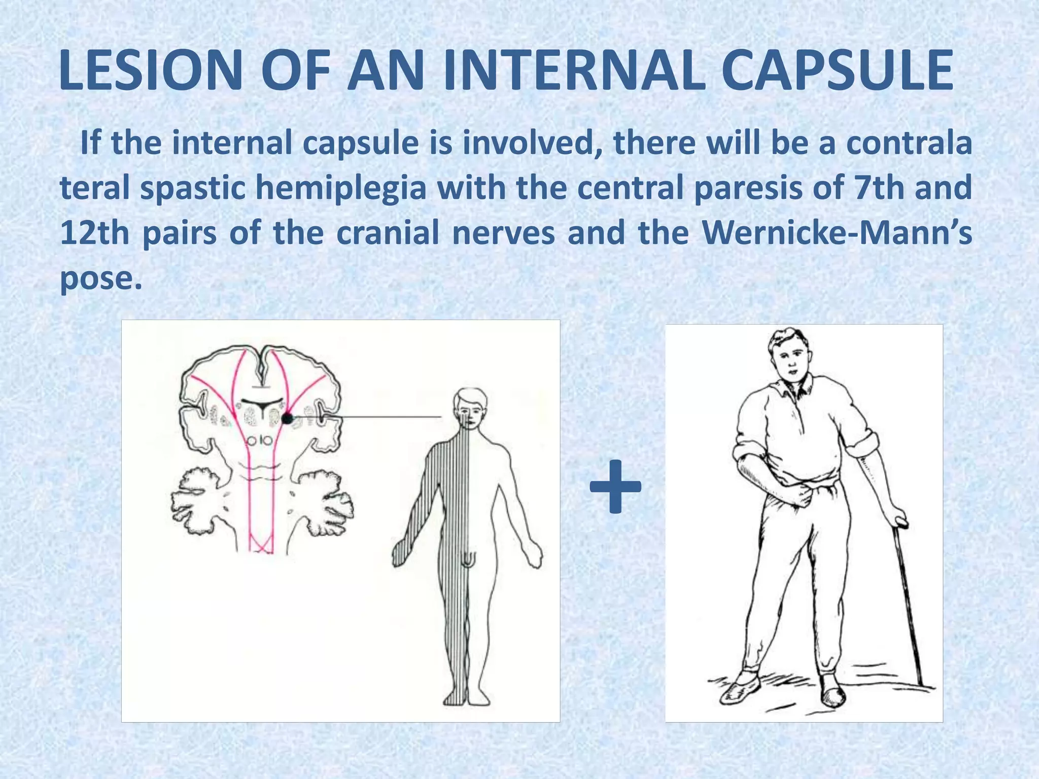 Motor System (Neurology 1) | PPTX