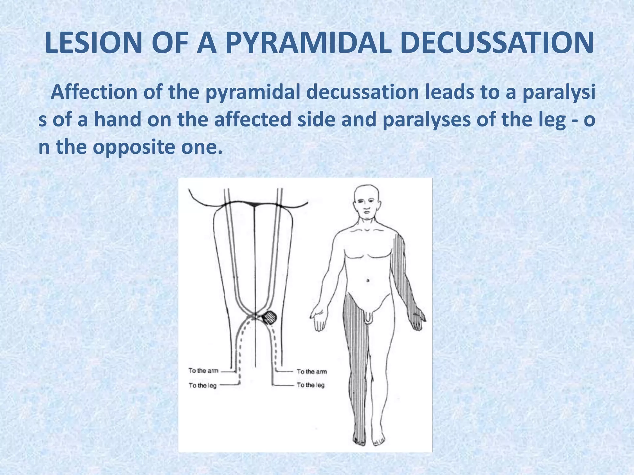 Motor System (Neurology 1) | PPTX