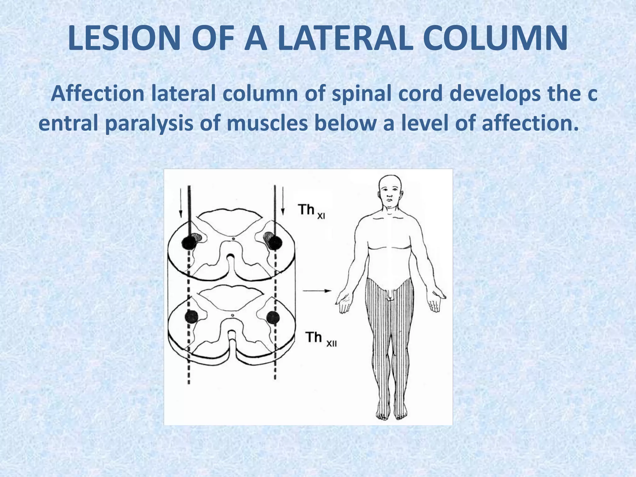 Motor System (Neurology 1) | PPTX