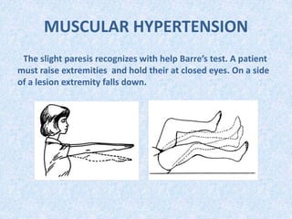 Motor System (Neurology 1) | PPTX