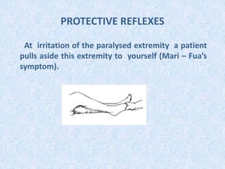 Motor System (Neurology 1) | PPTX