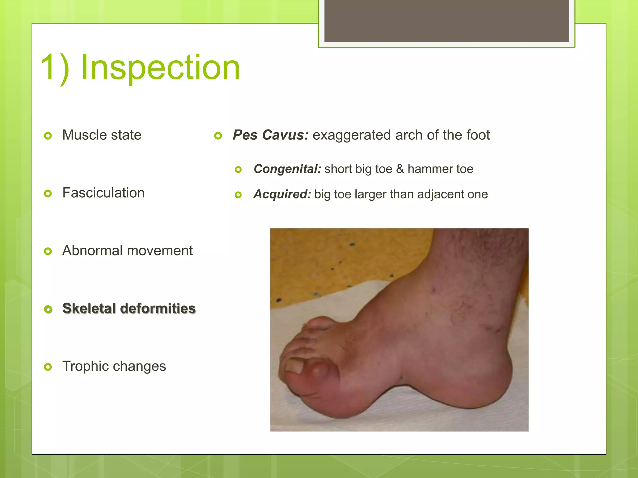 Motor system examination | PPTX