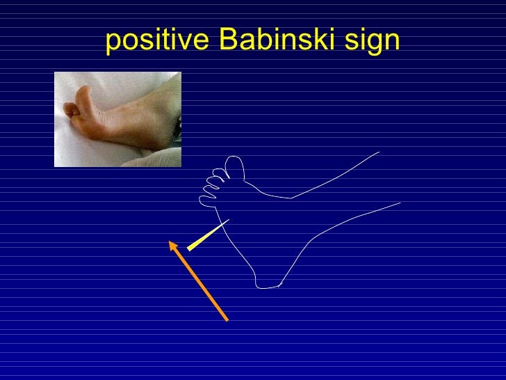 Motor system1 reflexes