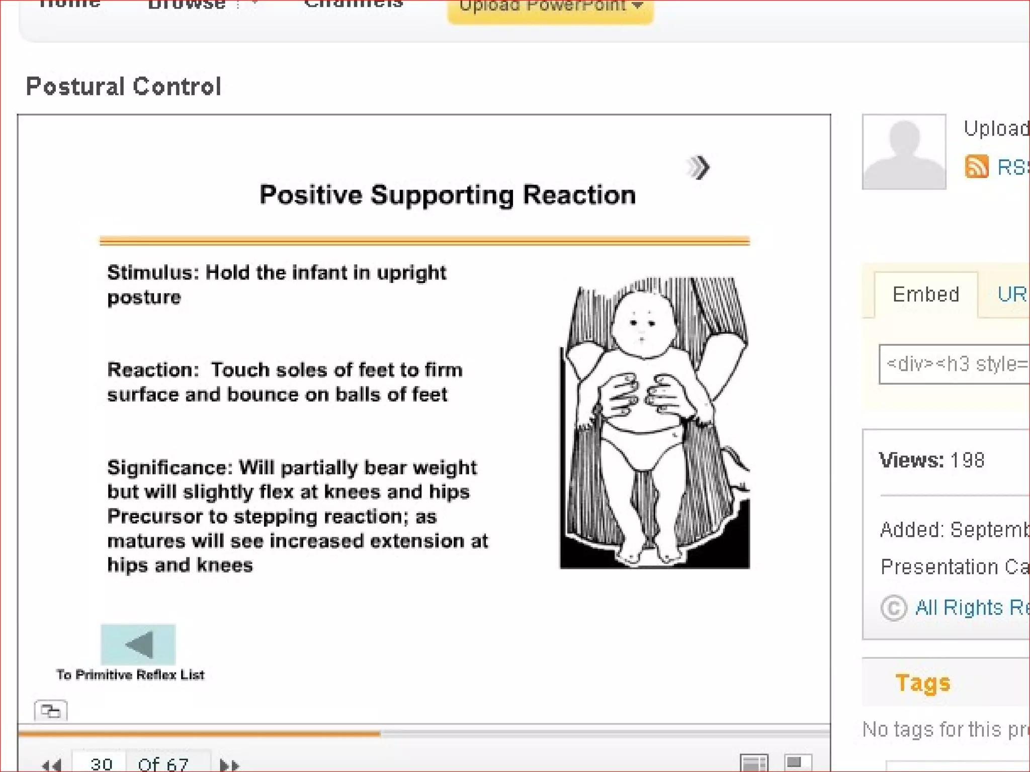 Motor system5 posture | PPT