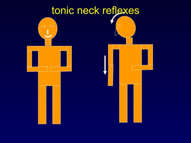 Motor system5 posture | PPT
