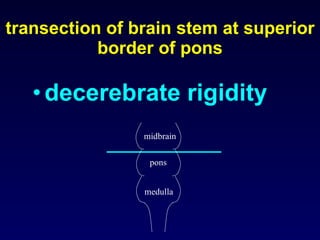 Decerebrate Rigidity