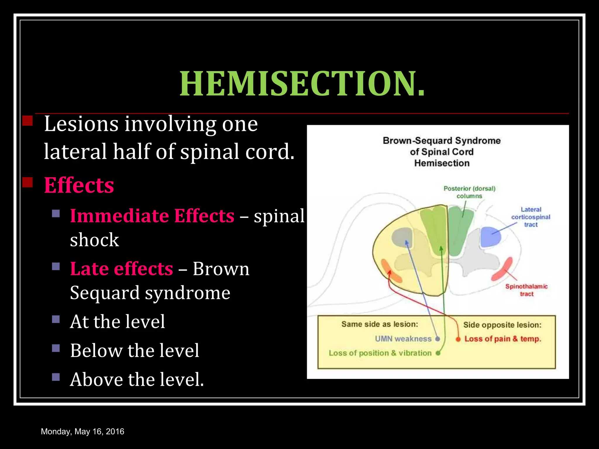 MOTOR SYSTEM SPINAL CORD | PPT