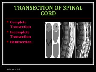 MOTOR SYSTEM SPINAL CORD | PPT