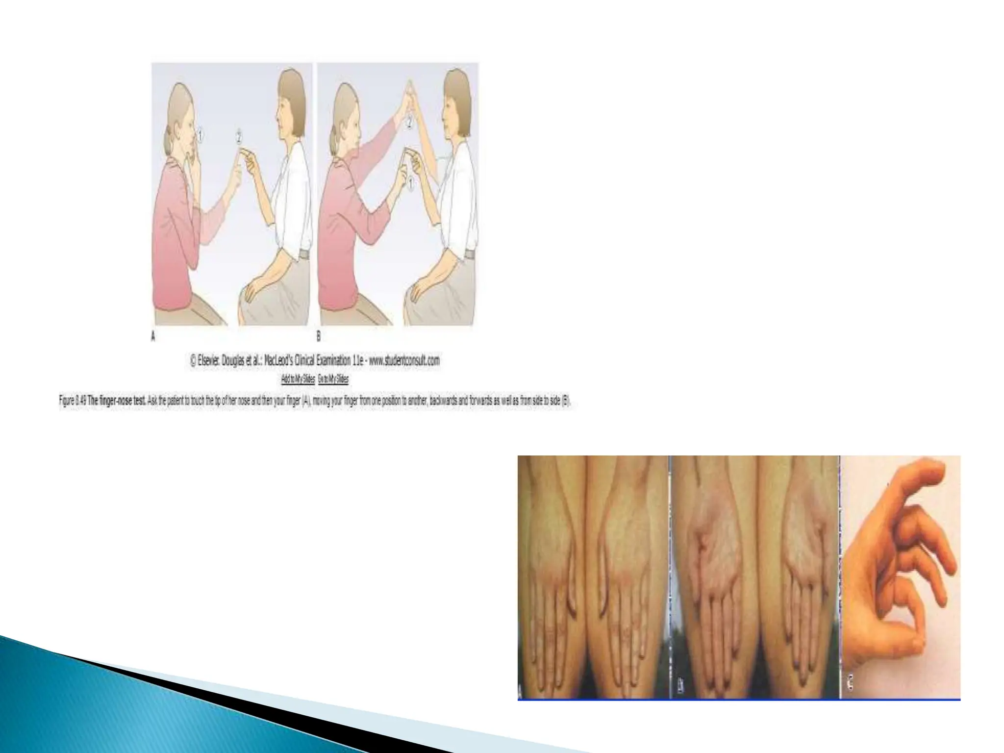 motor system examination physiology ppt.pptx