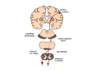 motor_weakness1-1......................ppt