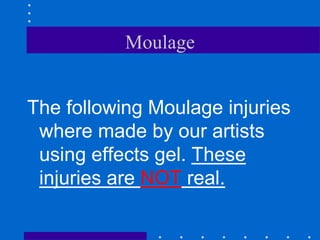 Moulage | PDF