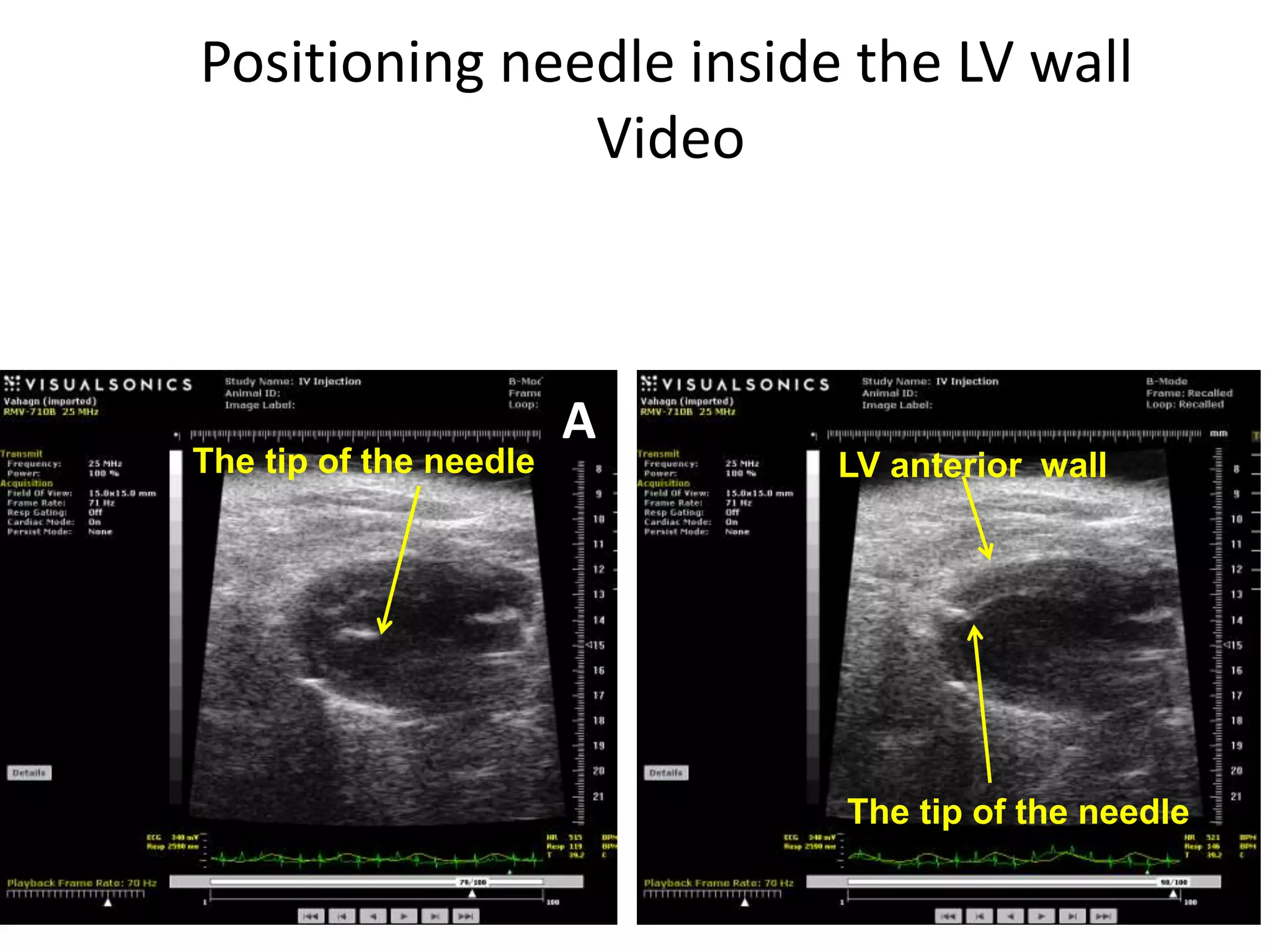 Mouse echocardiography, echo guided intraventricular and ...