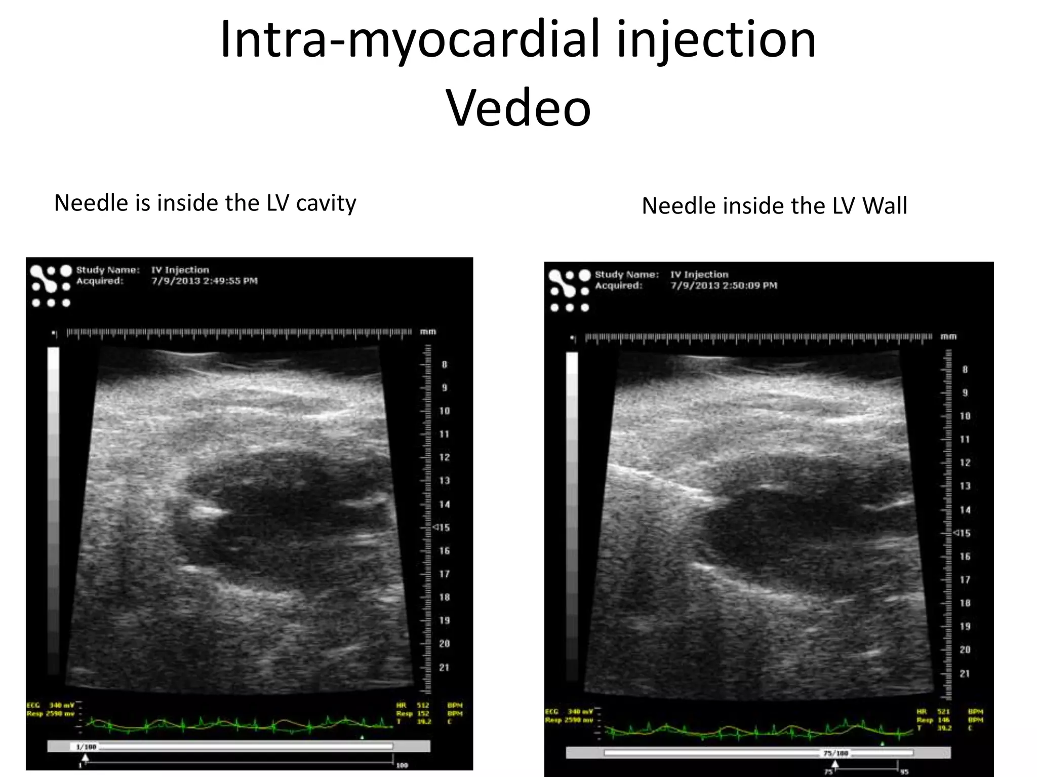 Mouse echocardiography, echo guided intraventricular and ...