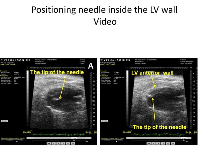 Mouse echocardiography, echo guided intraventricular and ...