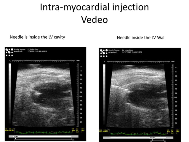 Mouse echocardiography, echo guided intraventricular and ...