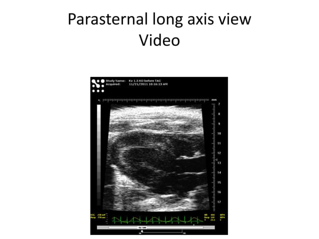 Mouse echocardiography, echo guided intraventricular and ...