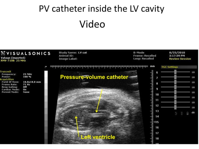 Mouse echocardiography, echo guided intraventricular and ...