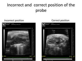 Mouse echocardiography, echo guided intraventricular and ...