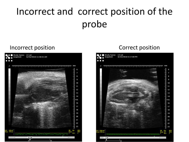 Mouse echocardiography, echo guided intraventricular and ...