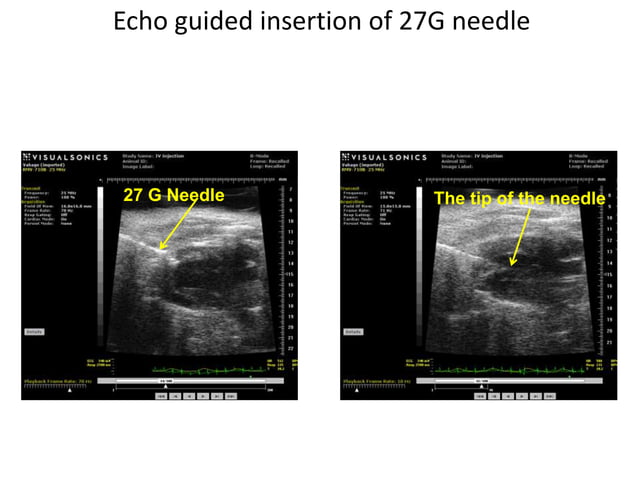 Mouse echocardiography, echo guided intraventricular and ...