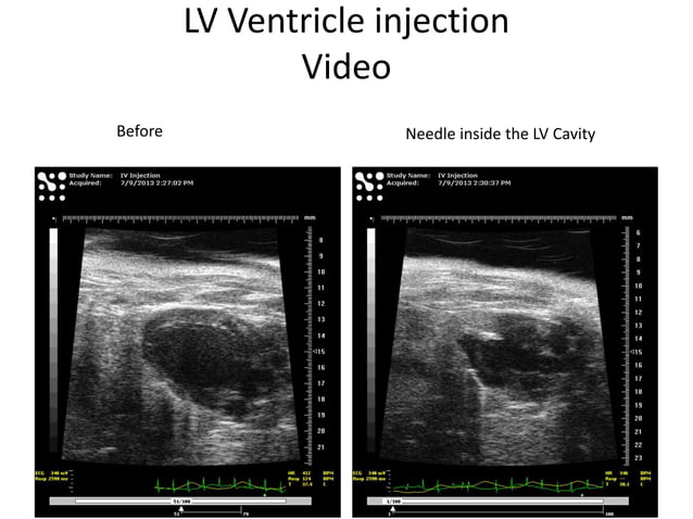 Mouse echocardiography, echo guided intraventricular and ...