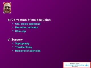 Mouth breathing | PPT