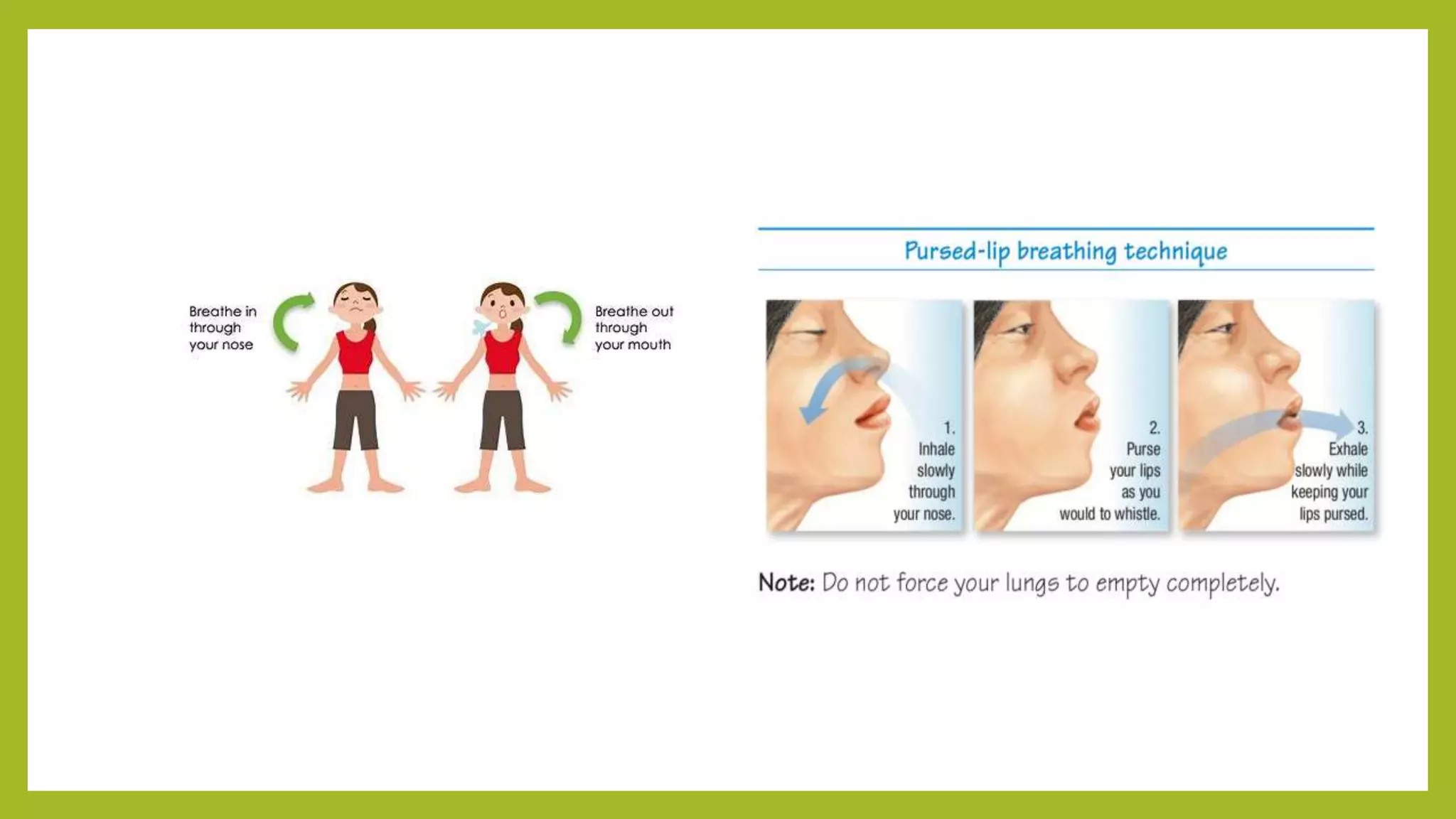 MOUTH BREATHING.pptx