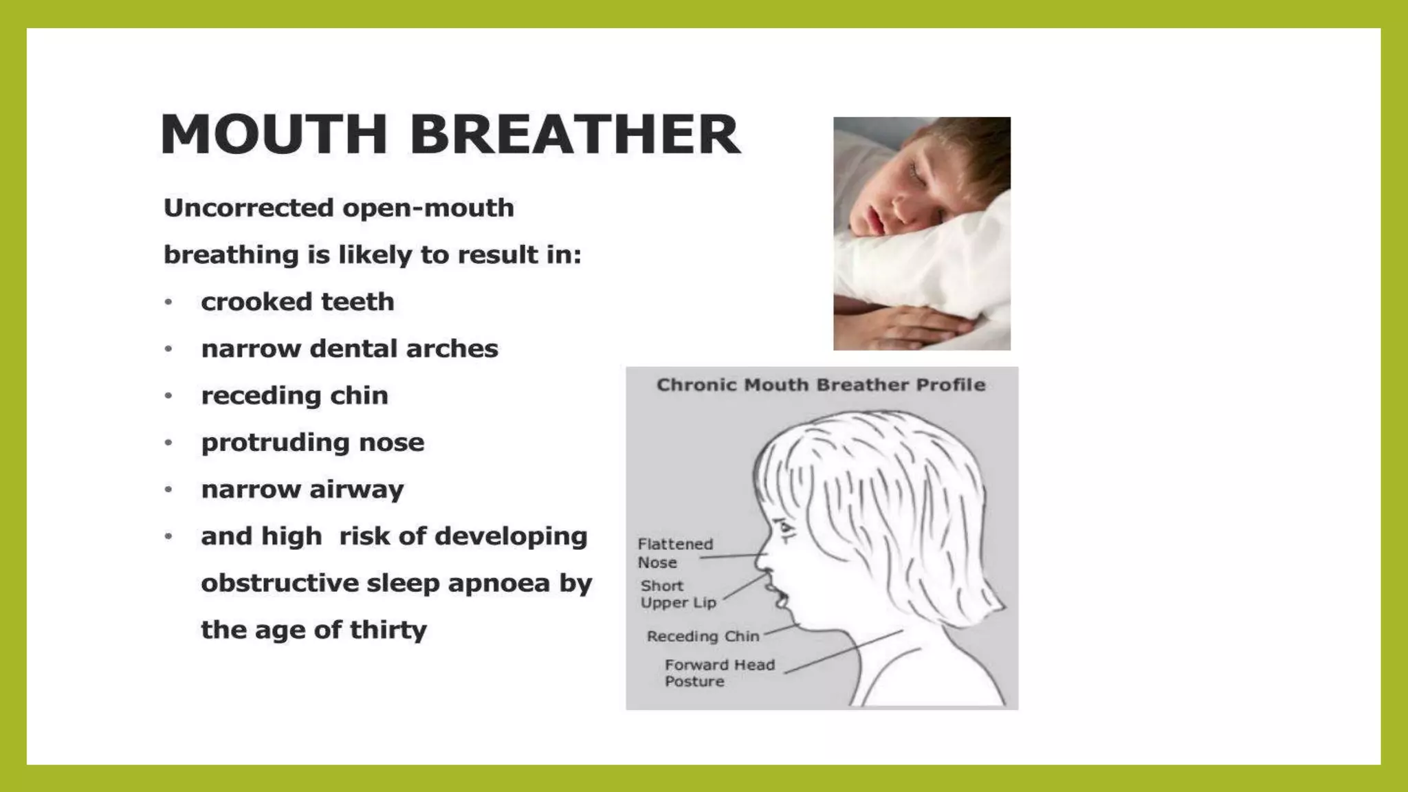 MOUTH BREATHING.pptx