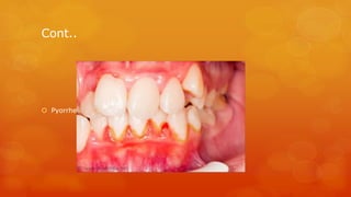 Mouth care | PPTX