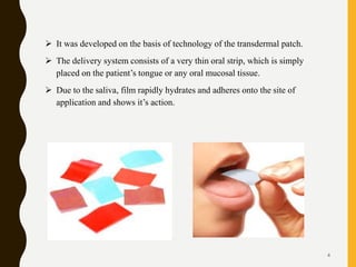 Mouth dissolving films | PPTX