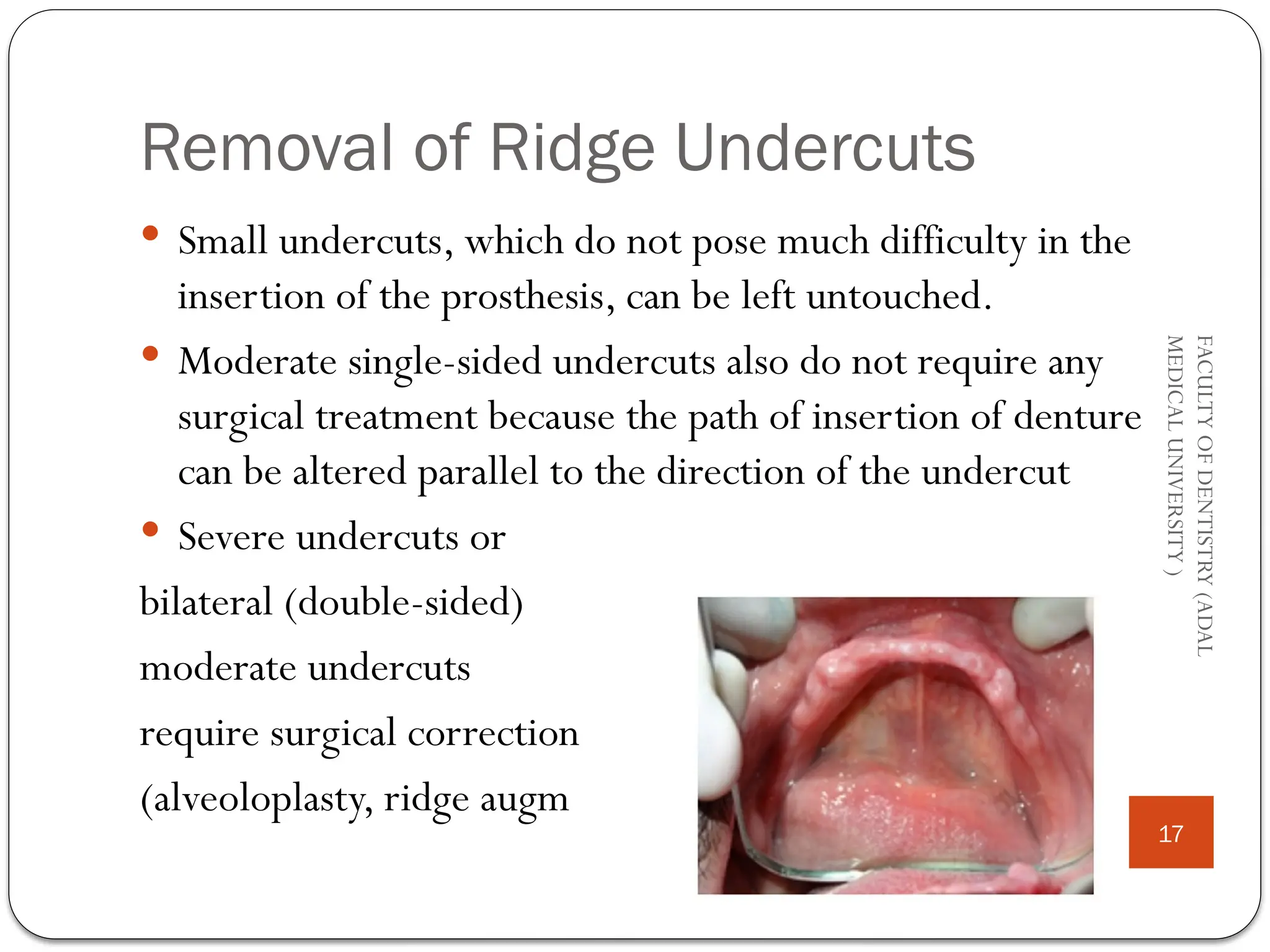 mouth preparation for Complete Denture By Dr Anmol Asghar Adal Medical ...