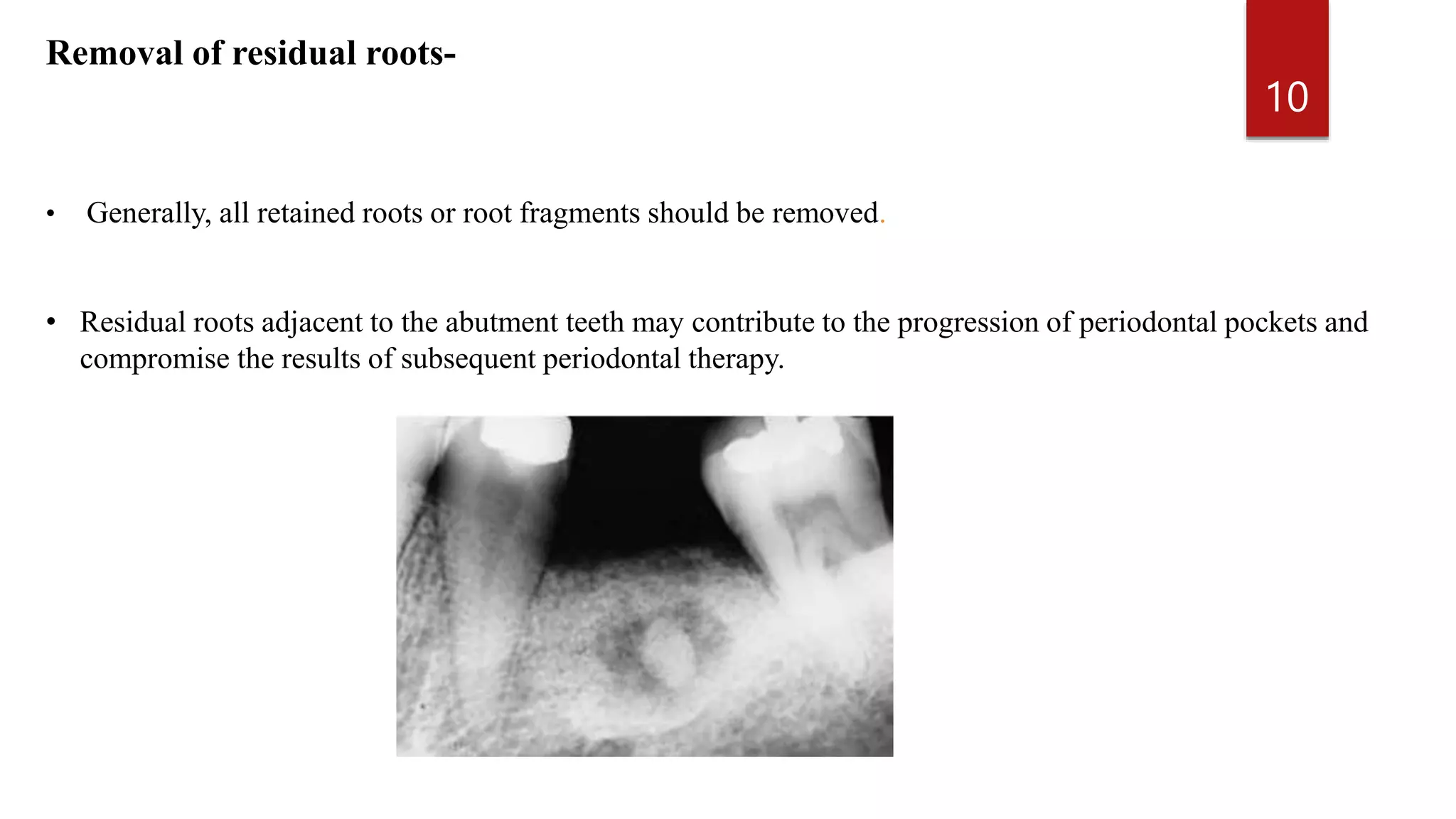 MOUTH PREPARATION FOR REMOVABLE PARTIAL DENTURES.pptx