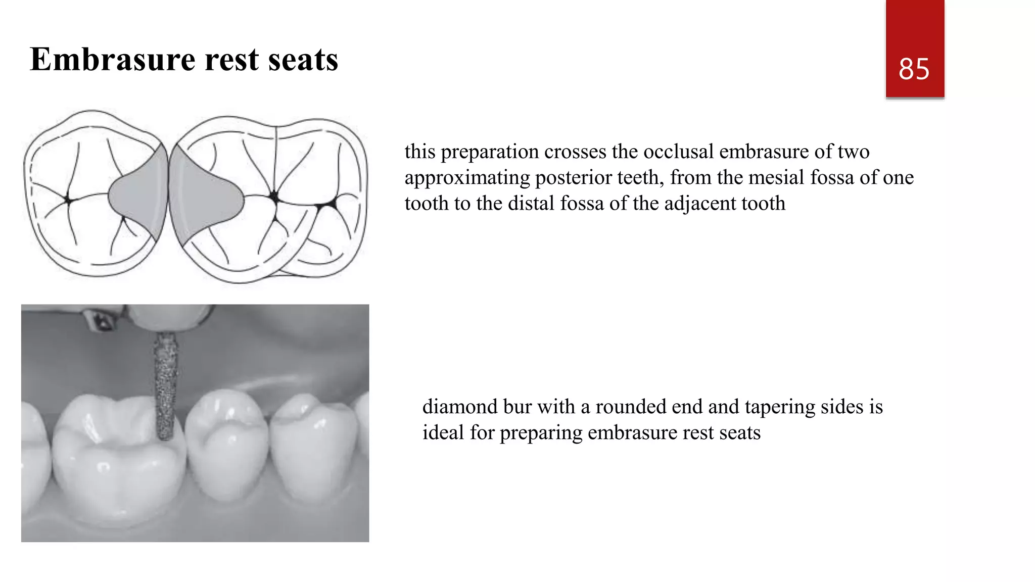 MOUTH PREPARATION FOR REMOVABLE PARTIAL DENTURES.pptx