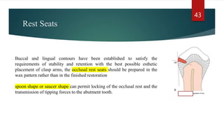 MOUTH PREPARATION FOR REMOVABLE PARTIAL DENTURES.pptx