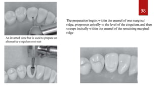 MOUTH PREPARATION FOR REMOVABLE PARTIAL DENTURES.pptx