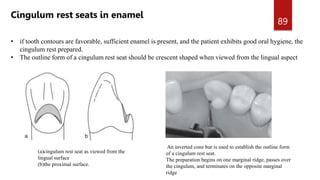 MOUTH PREPARATION FOR REMOVABLE PARTIAL DENTURES.pptx