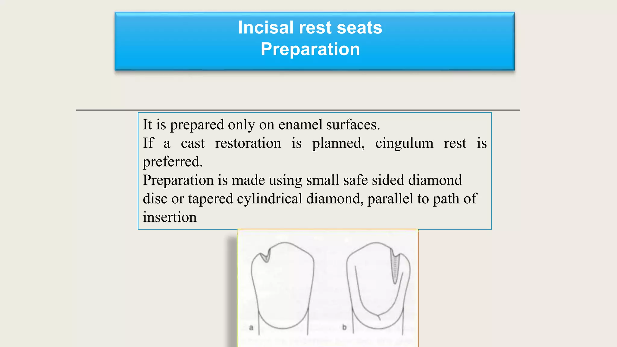 Mouth Preparation For Removable Partial Dentures.pptx