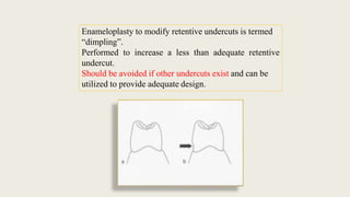 Mouth Preparation For Removable Partial Dentures.pptx
