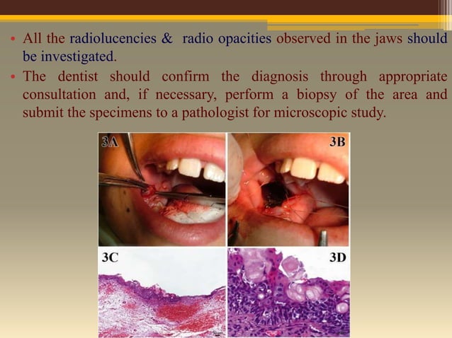mouth preparation for rpd (2).pptx | Dental Health | Diseases and ...