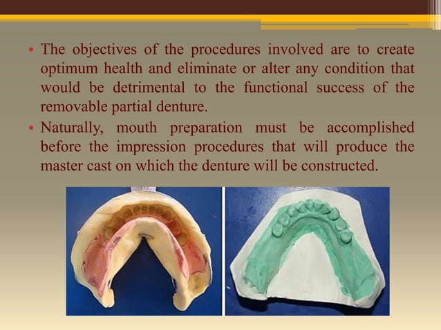 mouth preparation for rpd (2).pptx | Dental Health | Diseases and ...