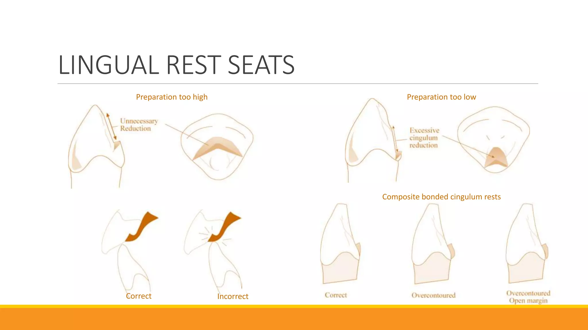 MOUTH PREPARATION IN CAST PARTIAL DENTURES | PPTX
