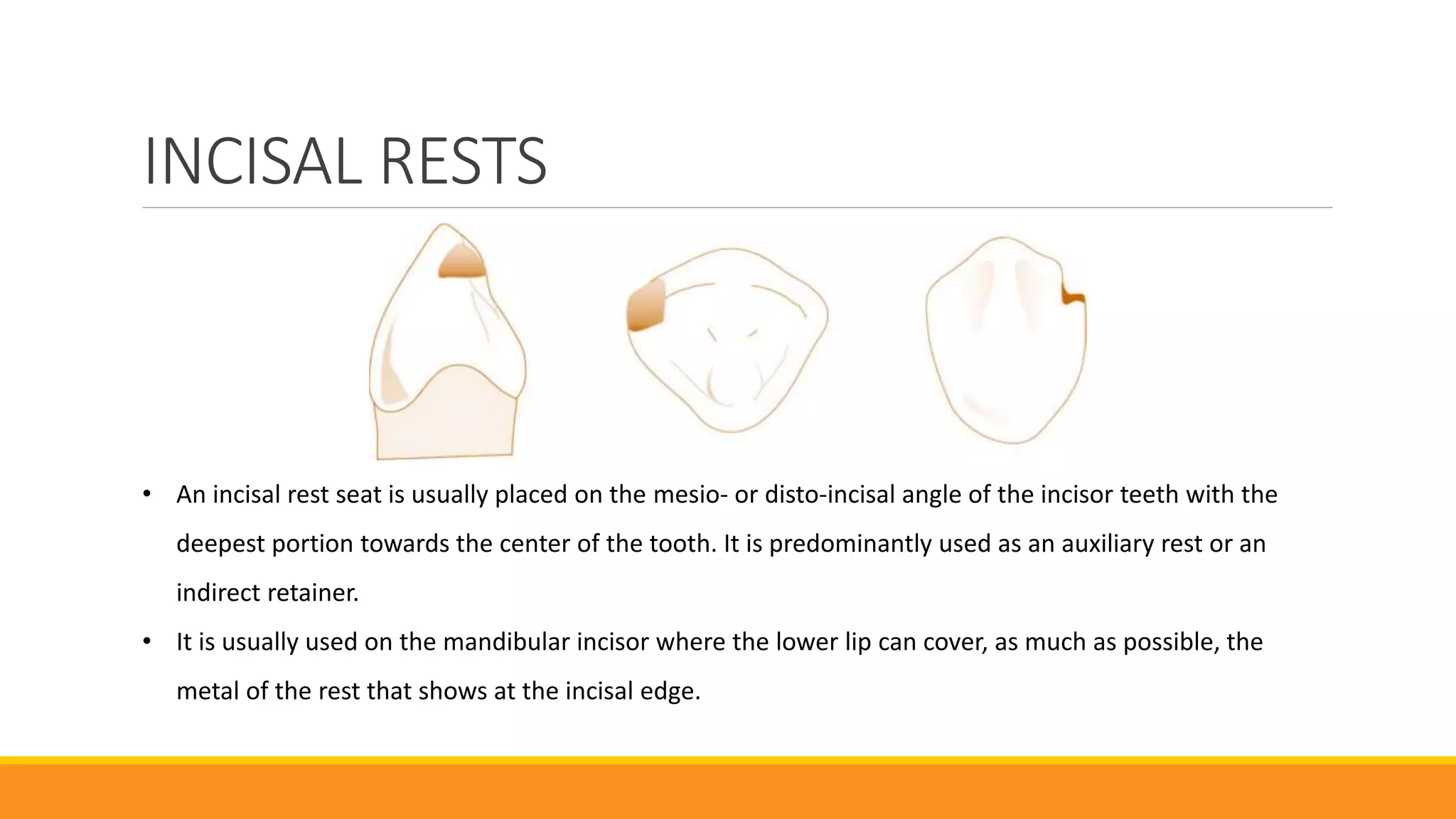MOUTH PREPARATION IN CAST PARTIAL DENTURES | PPTX