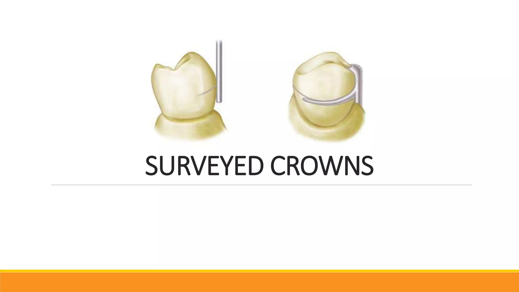 MOUTH PREPARATION IN CAST PARTIAL DENTURES | PPTX