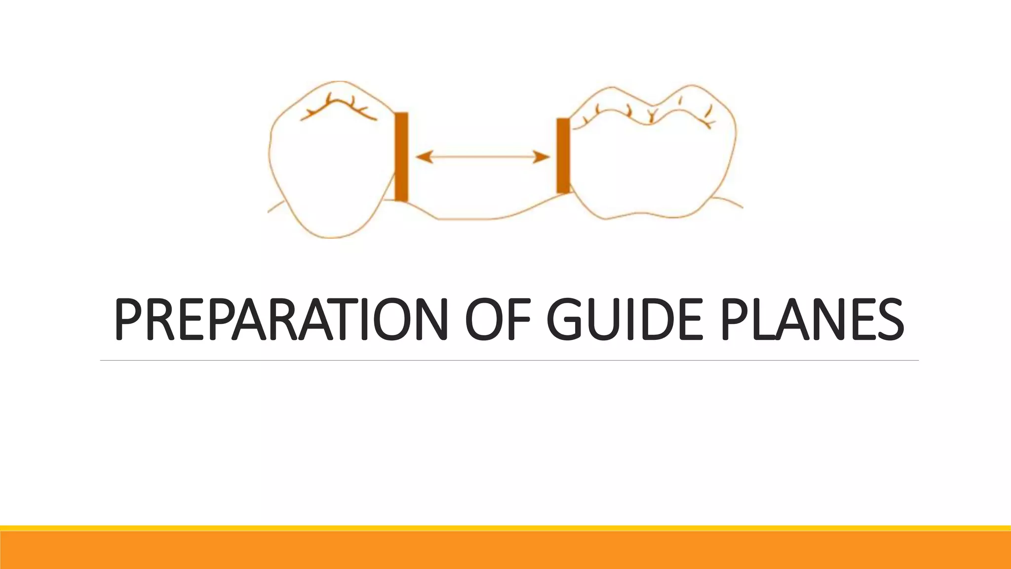 MOUTH PREPARATION IN CAST PARTIAL DENTURES | PPTX