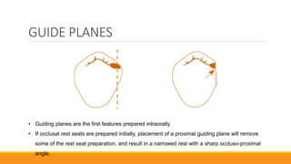 MOUTH PREPARATION IN CAST PARTIAL DENTURES | PPTX