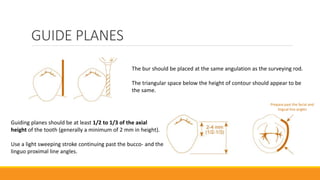 MOUTH PREPARATION IN CAST PARTIAL DENTURES | PPTX