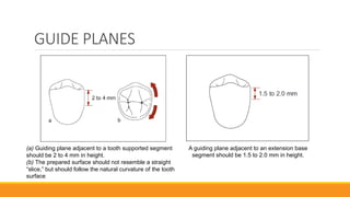 MOUTH PREPARATION IN CAST PARTIAL DENTURES | PPTX