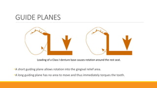 MOUTH PREPARATION IN CAST PARTIAL DENTURES | PPTX