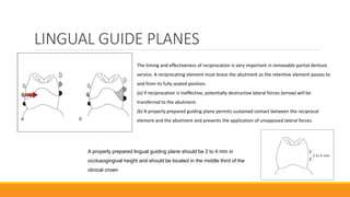 MOUTH PREPARATION IN CAST PARTIAL DENTURES | PPTX