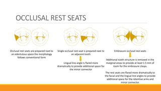 MOUTH PREPARATION IN CAST PARTIAL DENTURES | PPTX